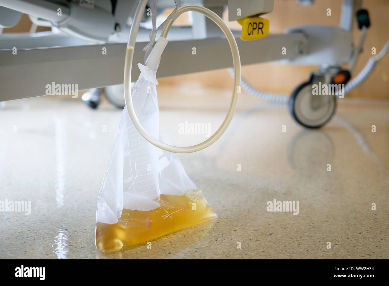 Plastic urine collection bag hang under patient bed in hospital, AF ...