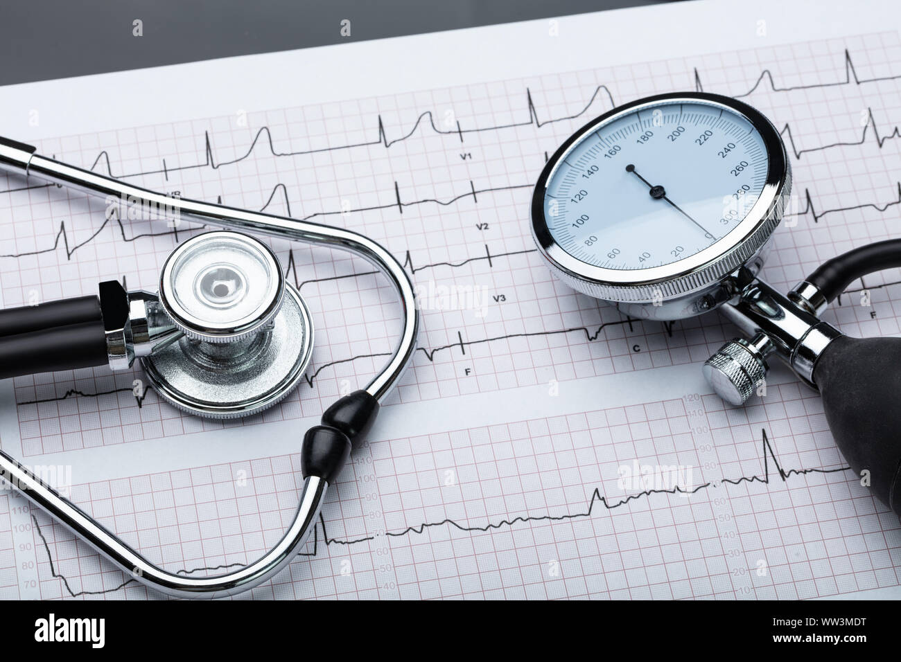 High Angle View Of Blood Pressure Gauge And Stethoscope On Cardiogram ...