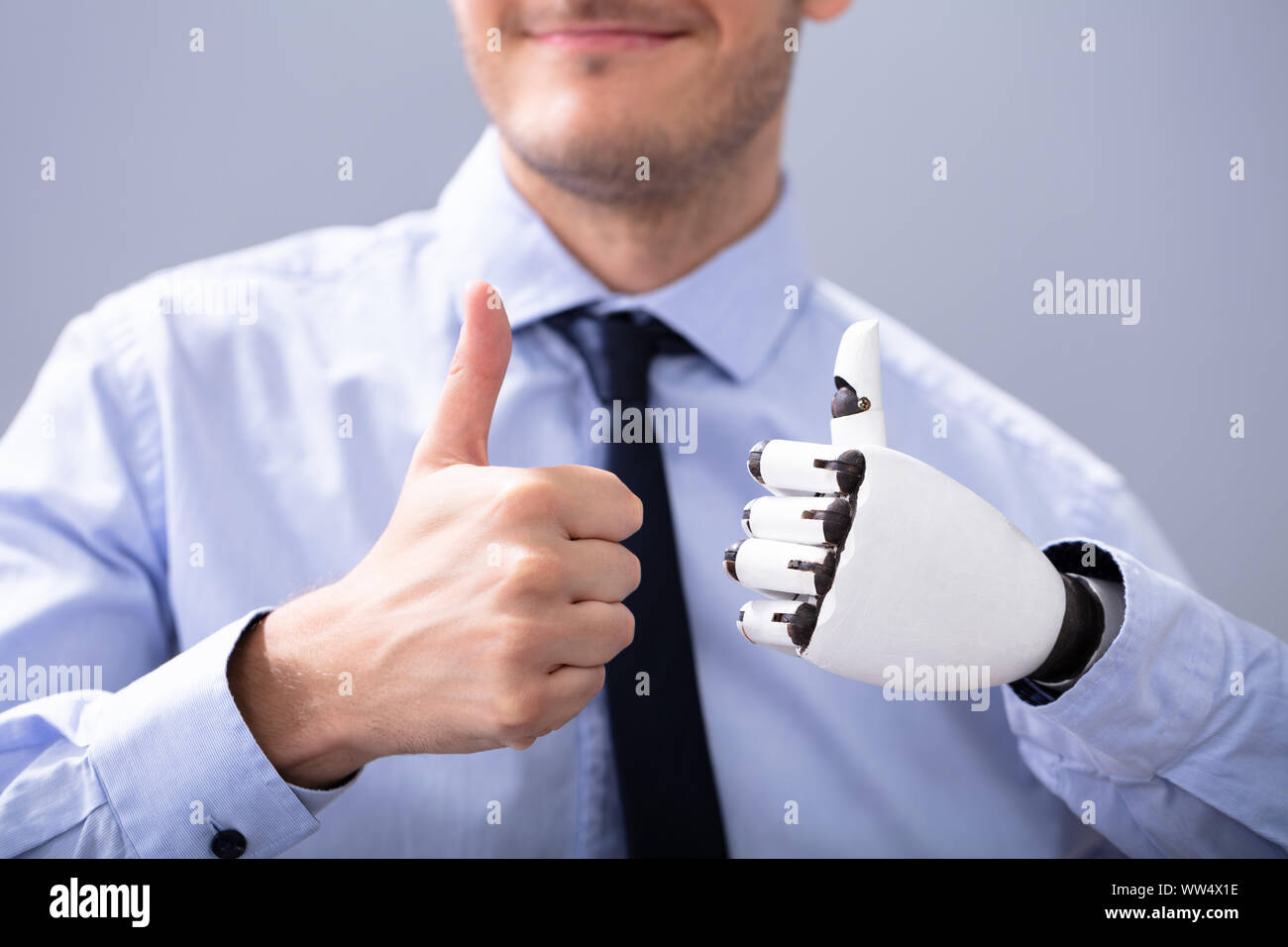 Businessperson With Prosthetic Limb Showing Thumb Up. Artificial Limb ...