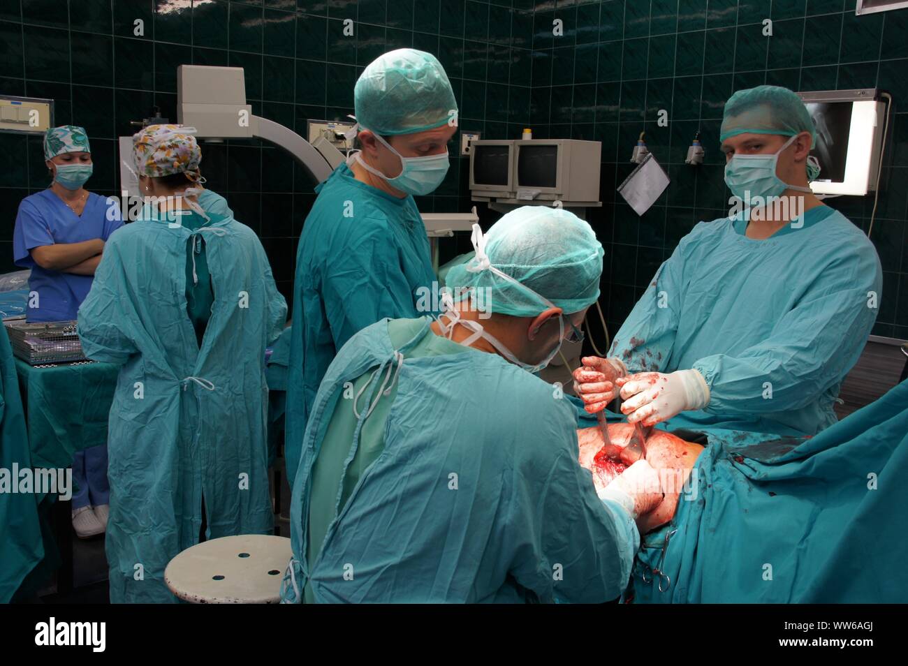 Anastomosis hi-res stock photography and images - Alamy