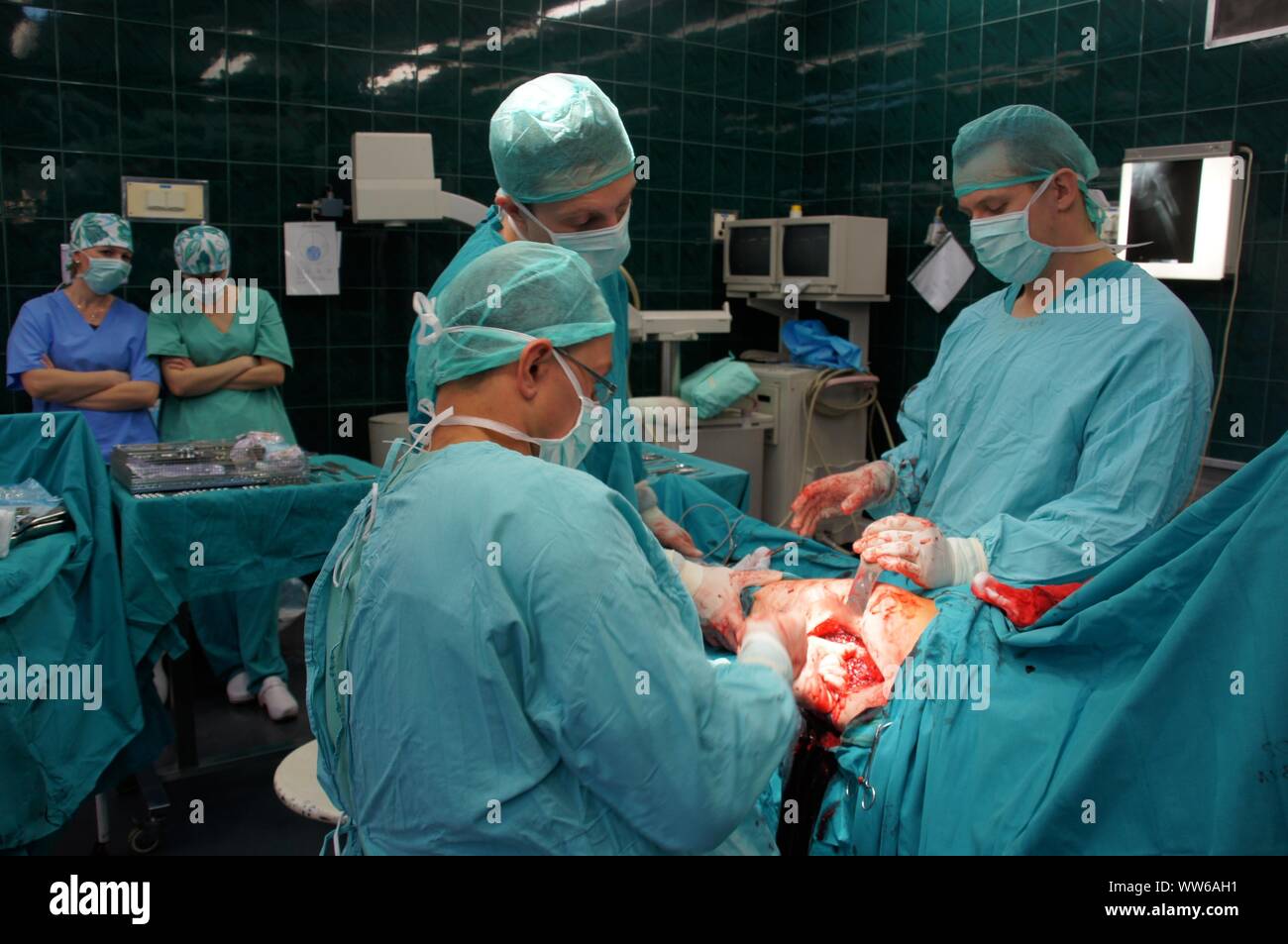 Anastomosis hi-res stock photography and images - Alamy