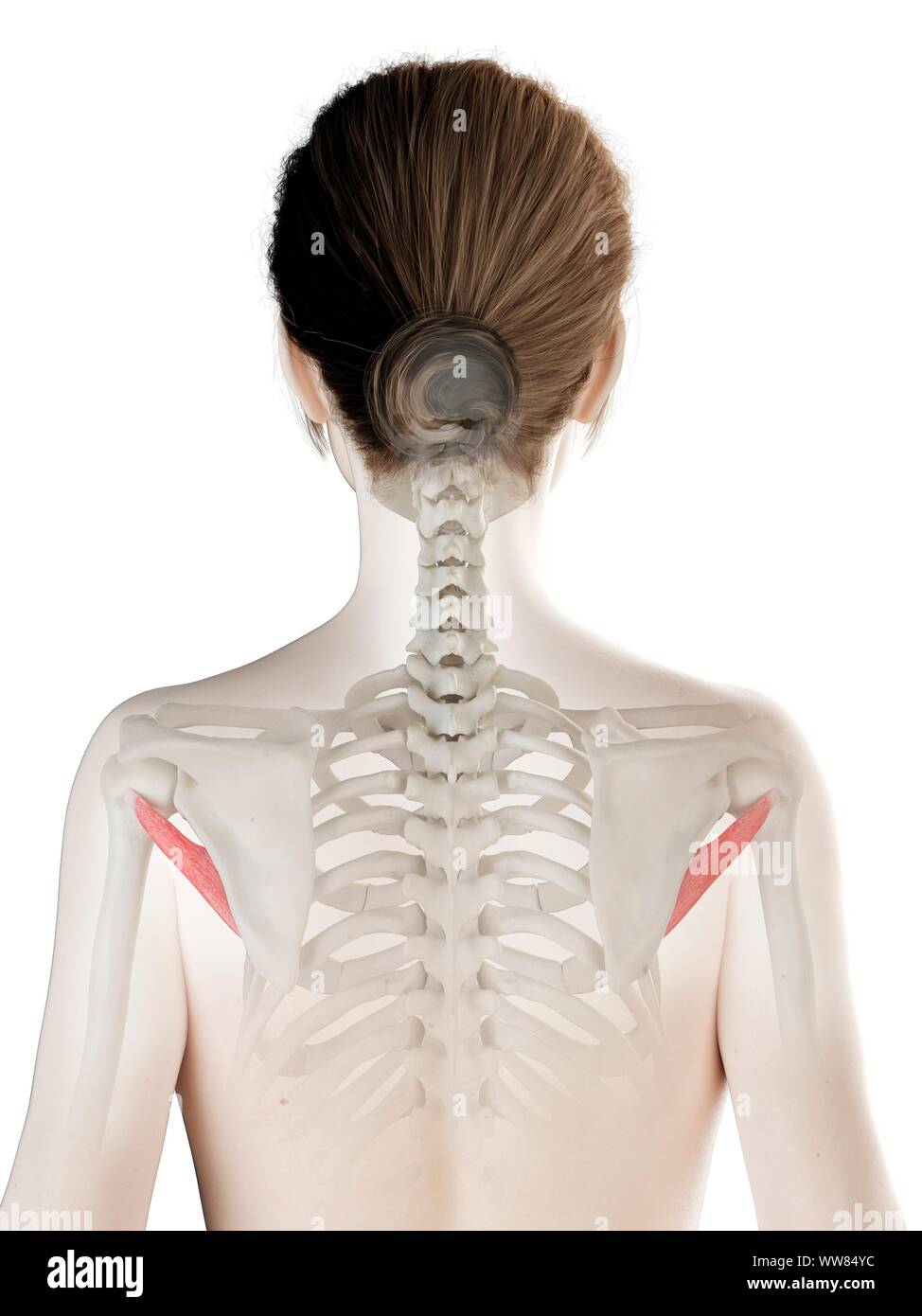Teres Minor Pain