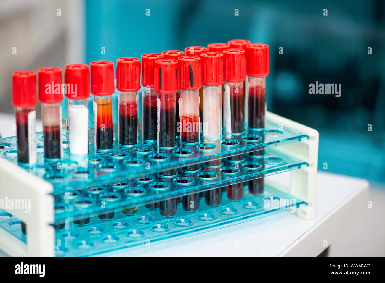 Medical blood test tubes equipment hi-res stock photography and images ...
