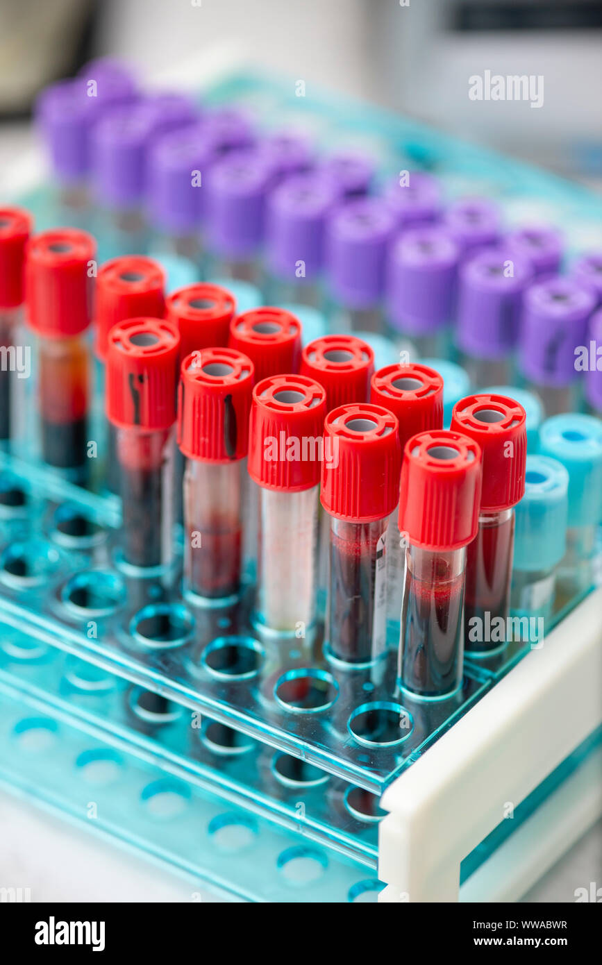 Tubes of blood sample for testing Stock Photo - Alamy