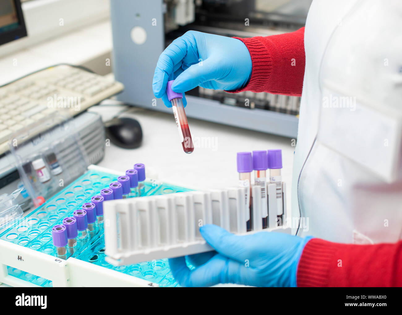 doctor hand taking a blood sample tube from a rack with machines of ...