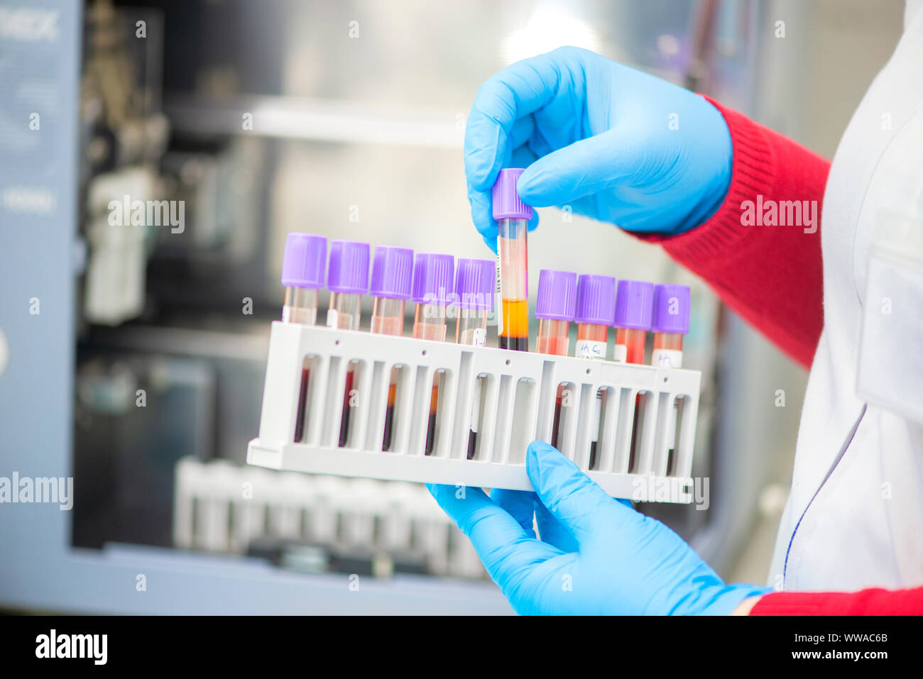 doctor hand taking a blood sample tube from a rack with machines of ...