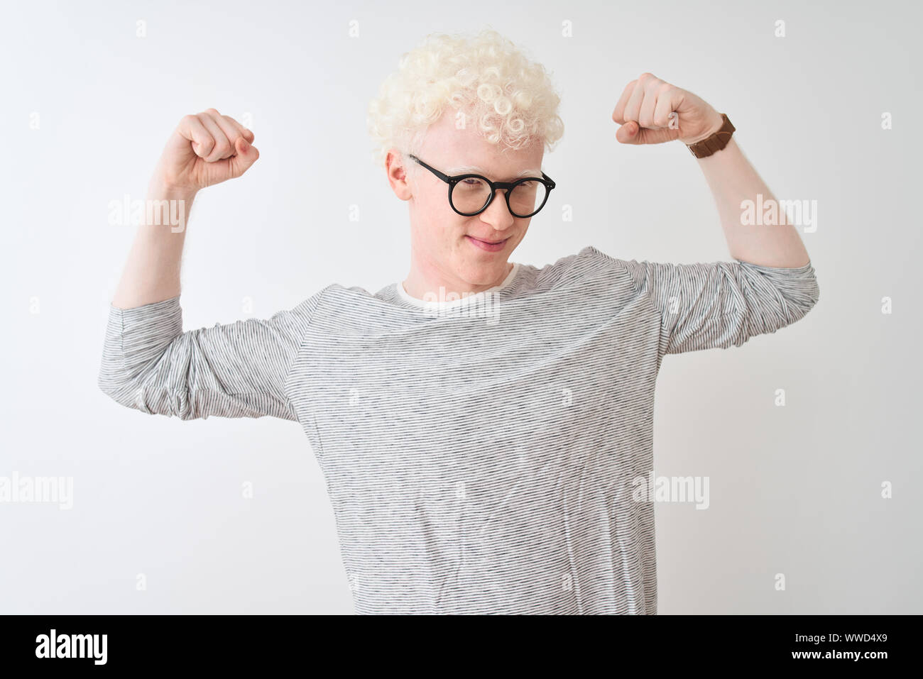 Young albino blond man wearing striped t-shirt and glasses over ...