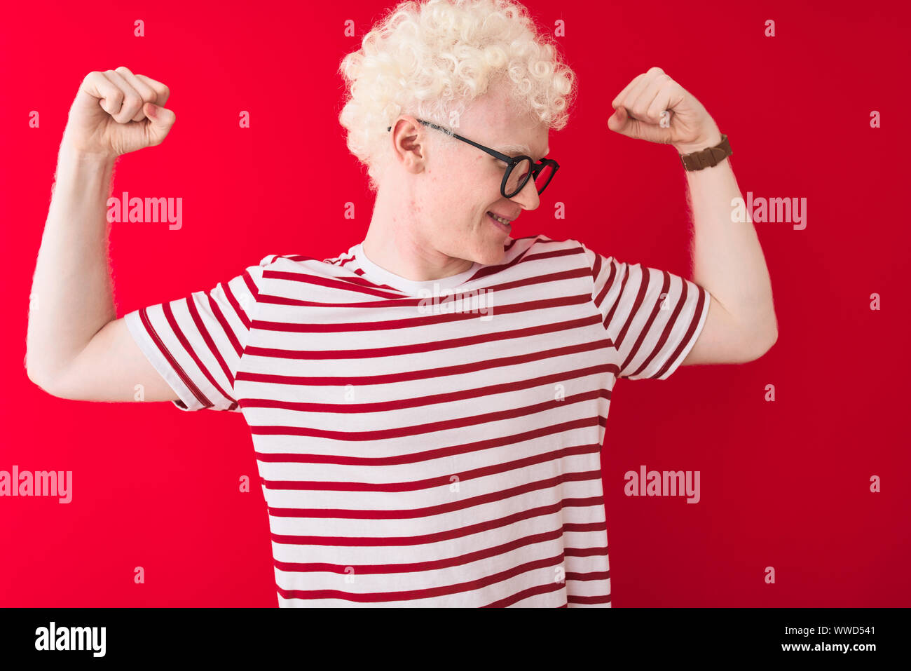 Young albino blond man wearing striped t-shirt and glasses over ...