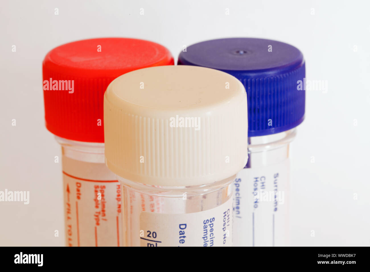 Universal sample containers Stock Photo - Alamy