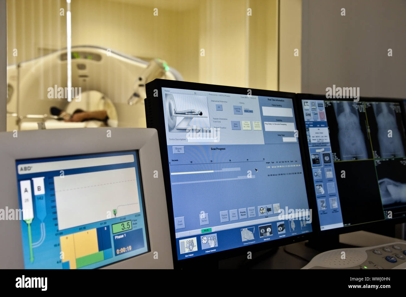 Magnetic resonance scan control room, focus on monitors Stock Photo - Alamy