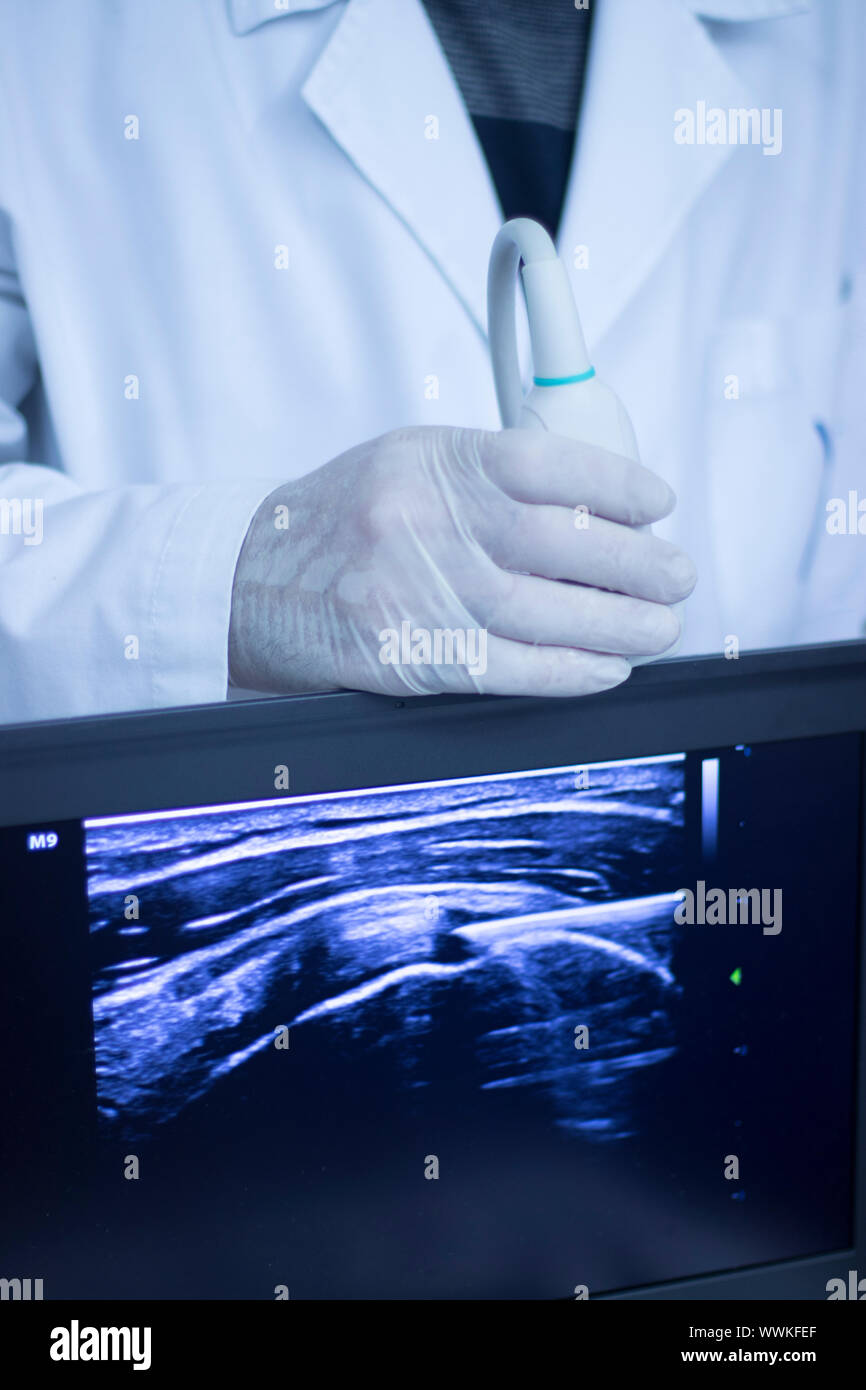 EPI Intratissue Percutaneous Electrolysis dry needling ultrasound ecography scan physiotherapy ...