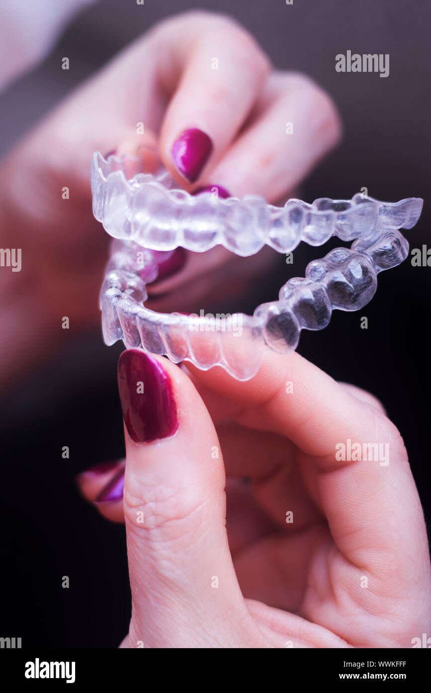 Clear dental teeth retainer brackets to straighten and align each tooth ...