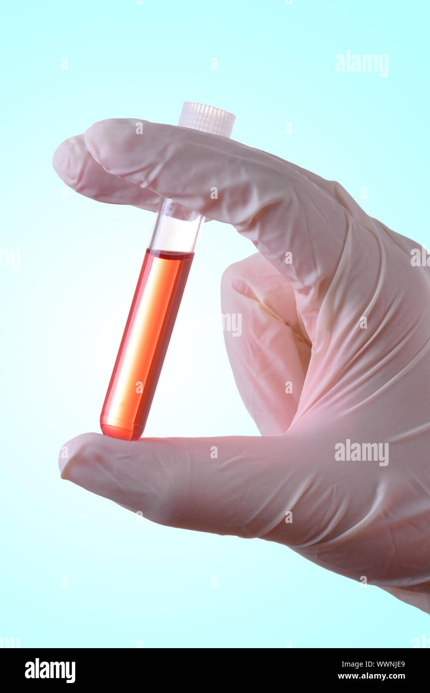 Hand holding vial poison hi-res stock photography and images - Alamy