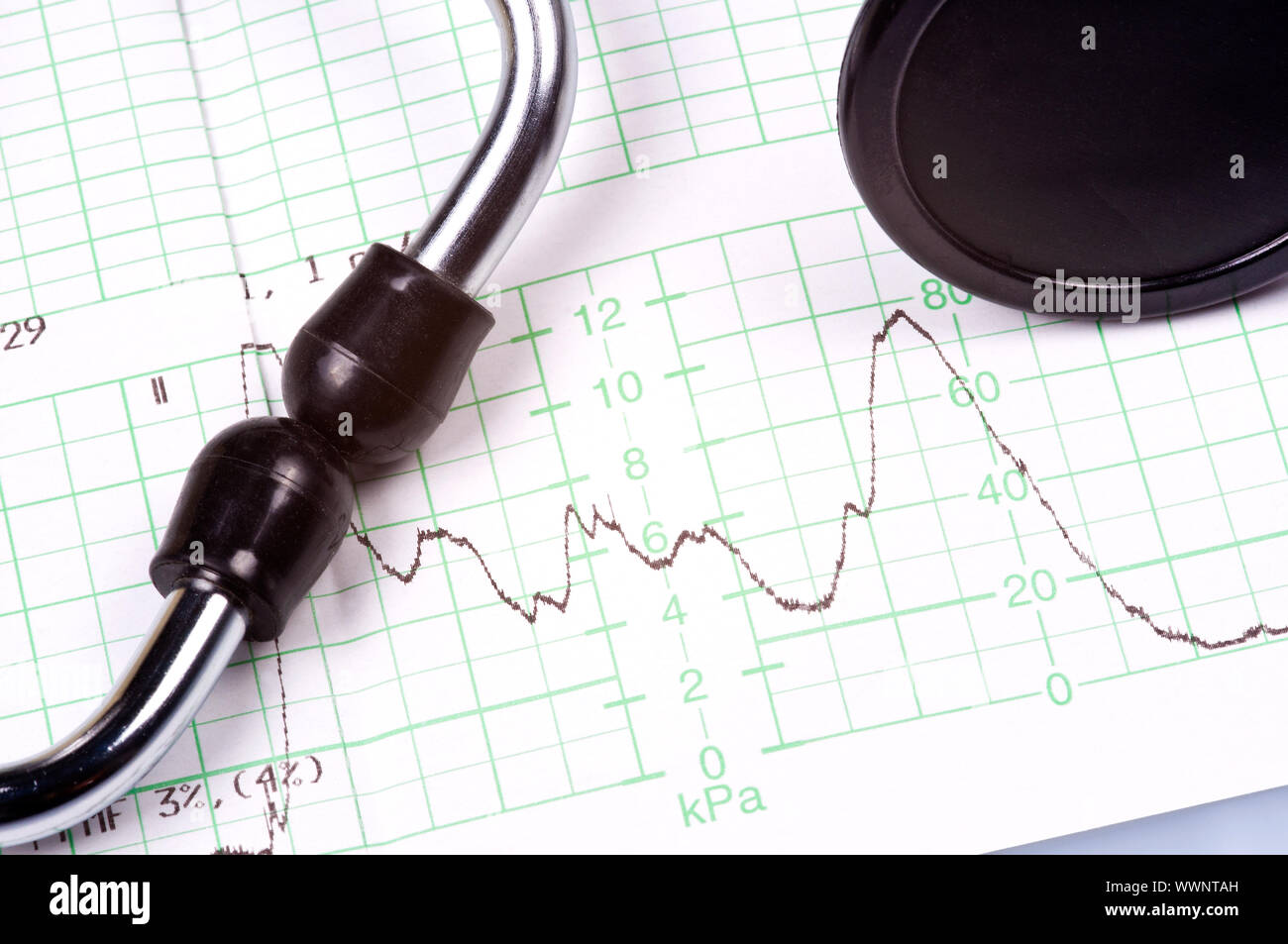 Medical graph and stethoscope Stock Photo - Alamy
