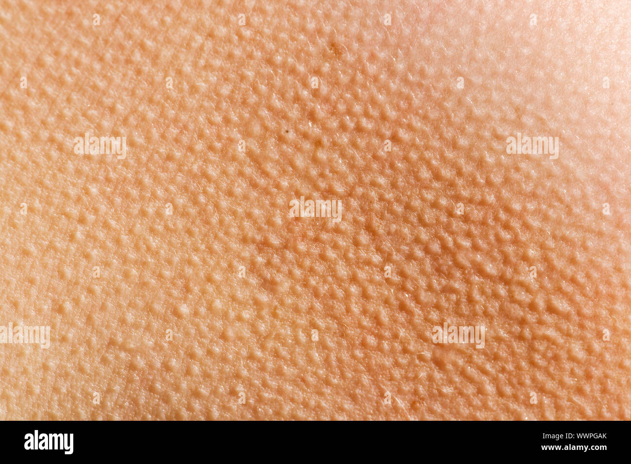 Goose bumps girl hi-res stock photography and images - Alamy