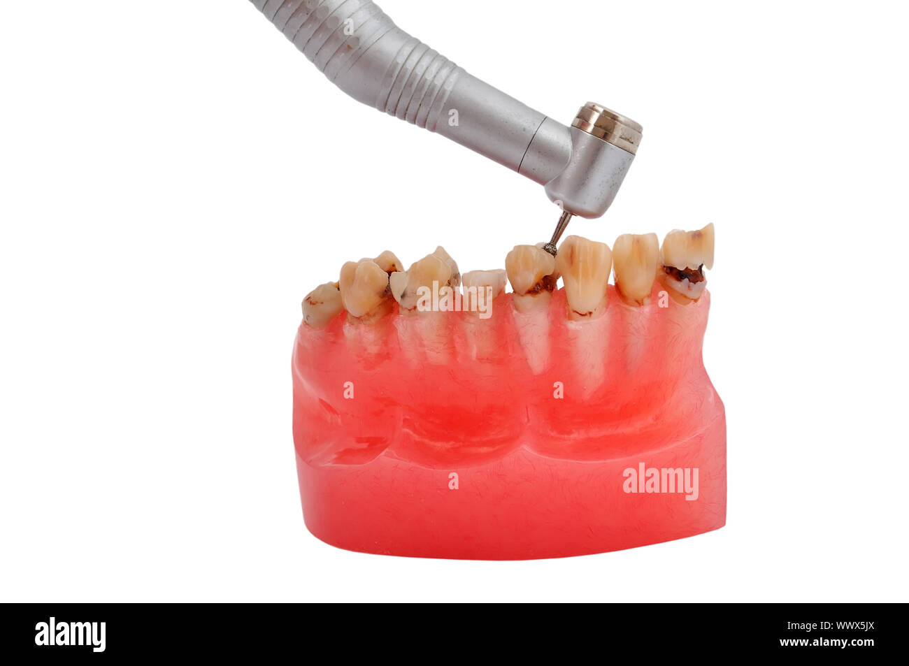 jaw affected tooth decay and dental handpiece Stock Photo - Alamy