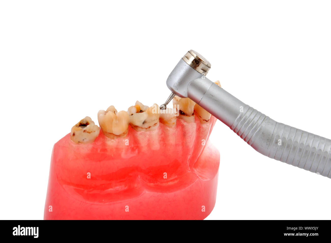 jaw affected tooth decay and dental handpiece Stock Photo - Alamy