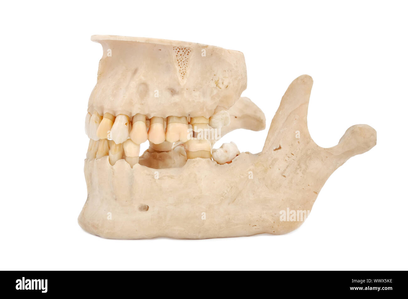 model of human teeth on a white background Stock Photo - Alamy