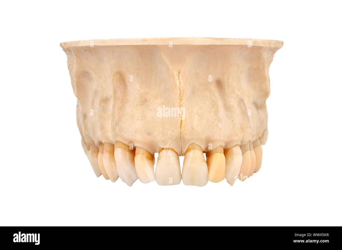 Human jawbone molars hi-res stock photography and images - Alamy