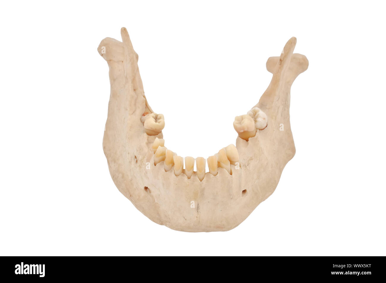 Lower human jaw on hi-res stock photography and images - Alamy