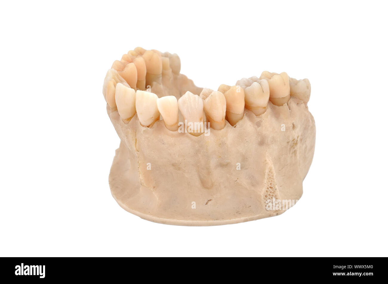 upper human jawbone on a white background Stock Photo - Alamy