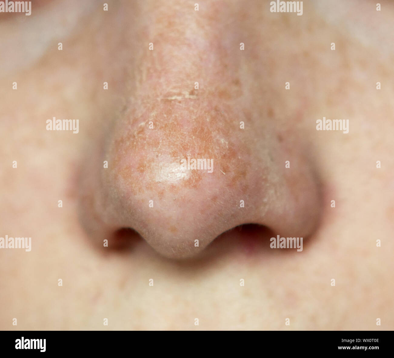 Woman nostril hair hi-res stock photography and images - Alamy