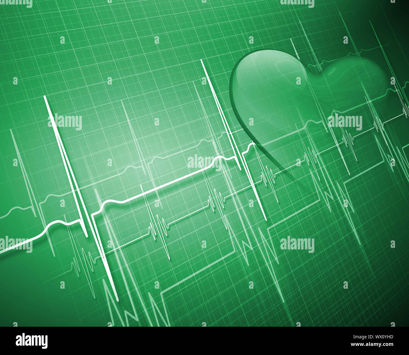 Ecg Monitor Death High Resolution Stock Photography and Images - Alamy