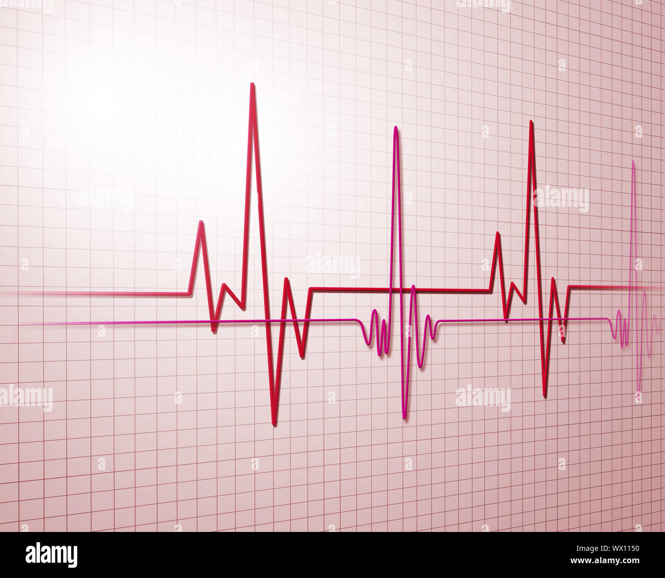 Ecg Monitor Death High Resolution Stock Photography and Images - Alamy