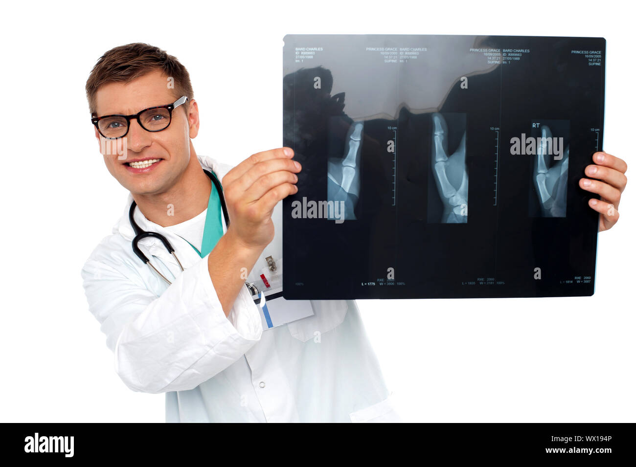 Young specialist peeping from behind x-ray report looking at camera ...