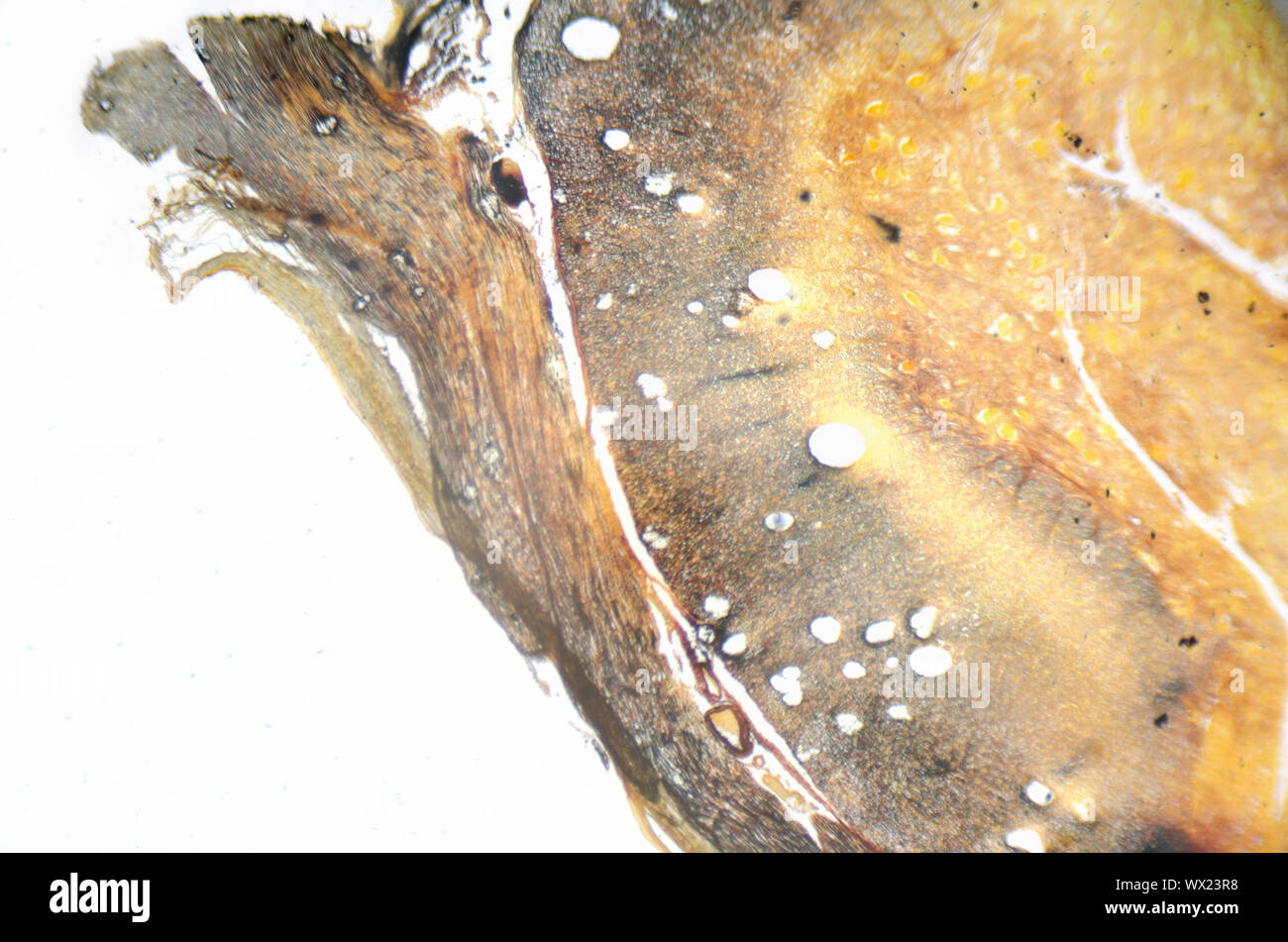 Microscope photography. Spinal cord, cross section Stock Photo - Alamy