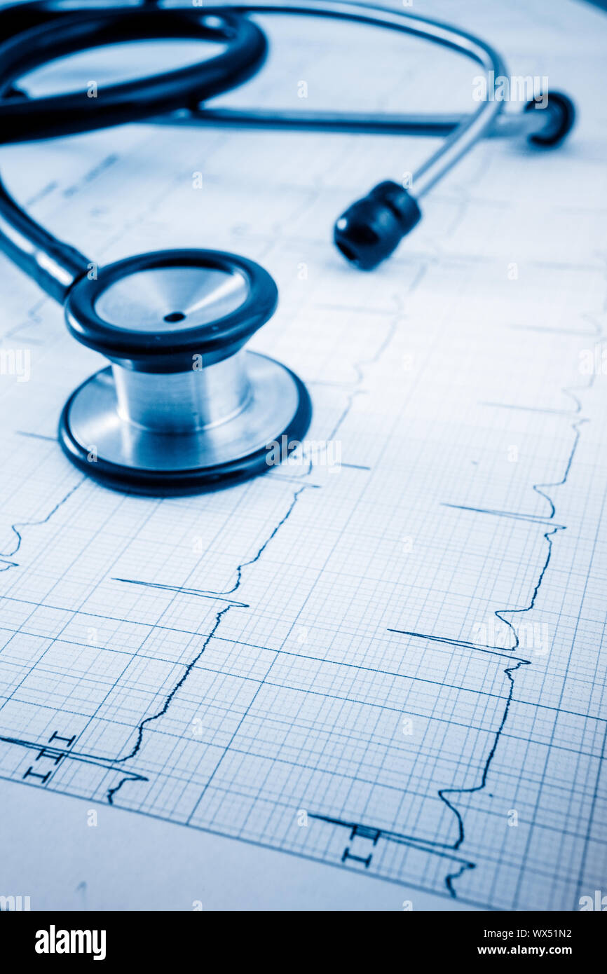 Stethoscope on cardiogram concept for heart care Stock Photo - Alamy