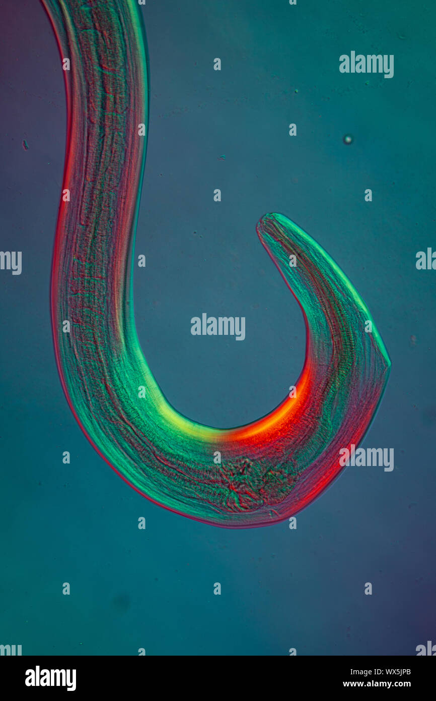 Hookworm hi-res stock photography and images - Alamy