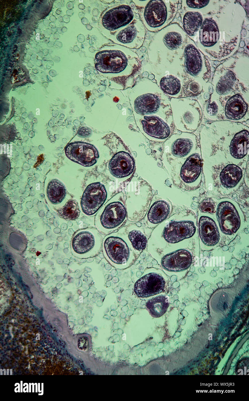 Echinococcus parasites in infected liver Stock Photo - Alamy