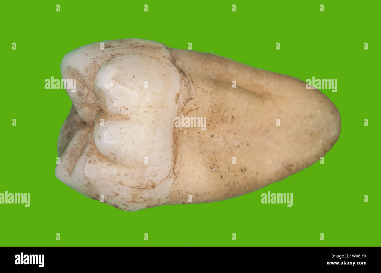 Tooth root hi-res stock photography and images - Alamy