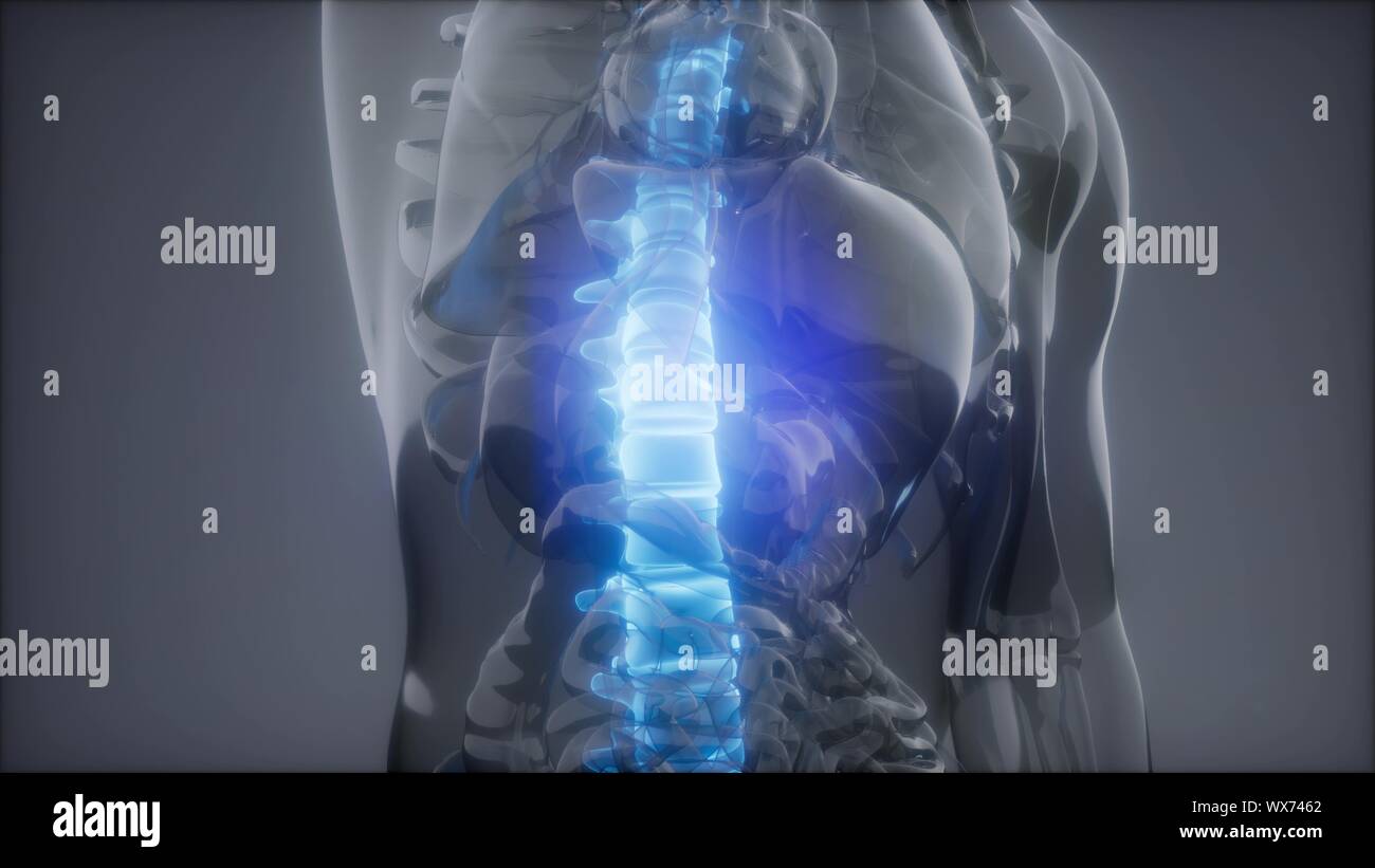 Backache in Back Bones Stock Photo - Alamy