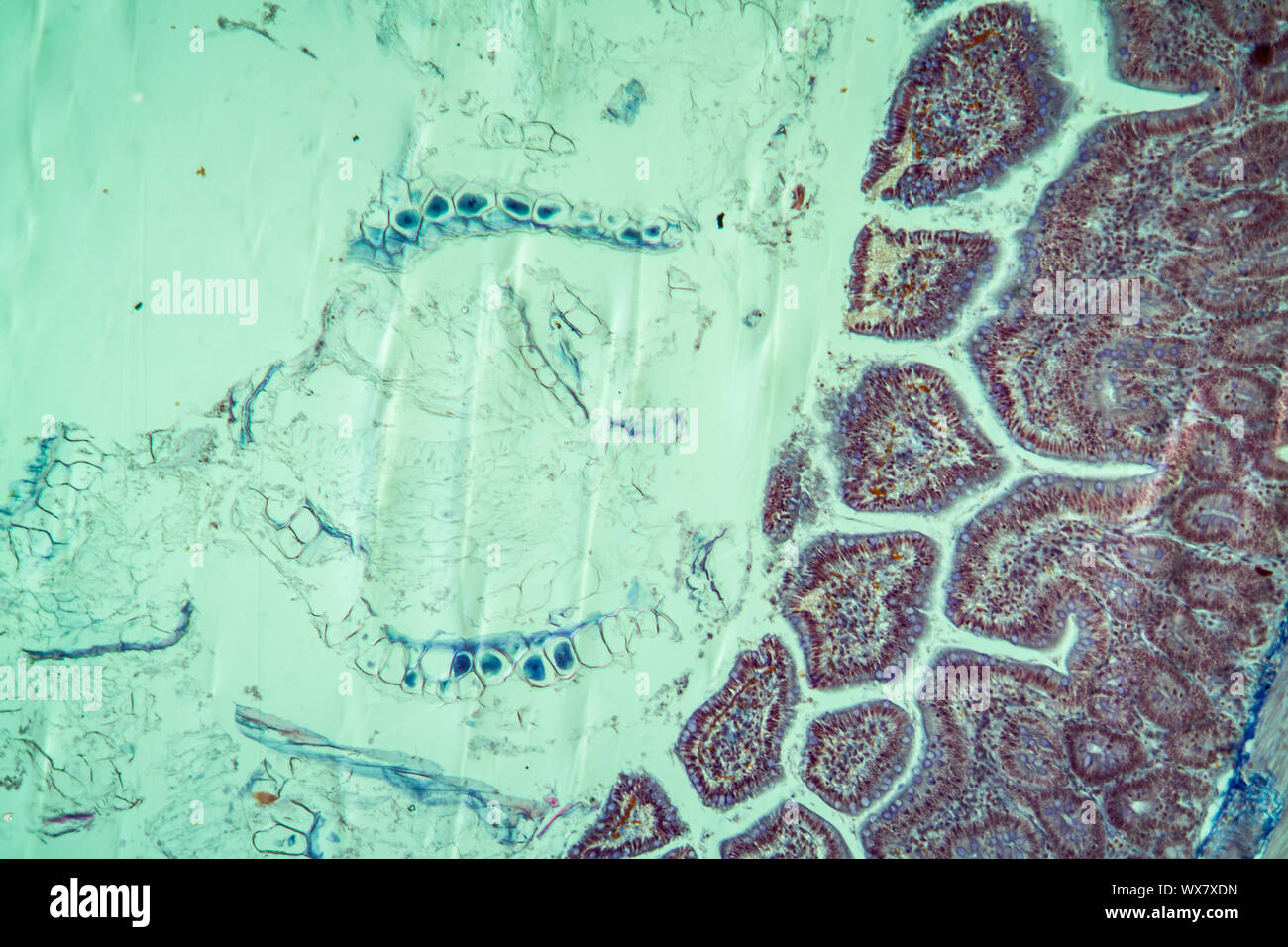 Amoebic dysentery intestine 100x Stock Photo - Alamy