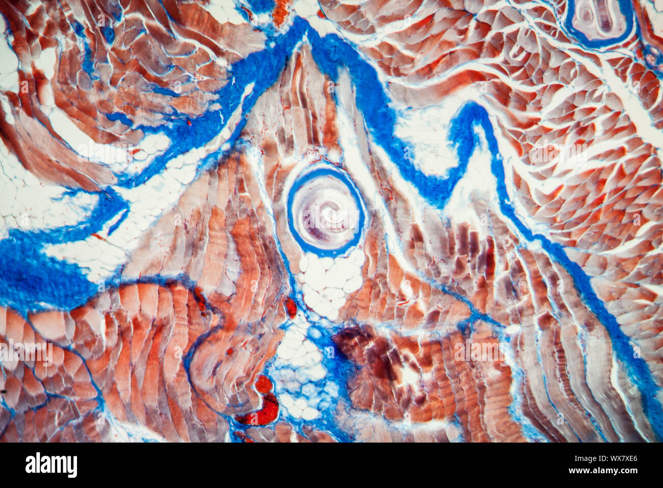 Nematodes hi-res stock photography and images - Alamy