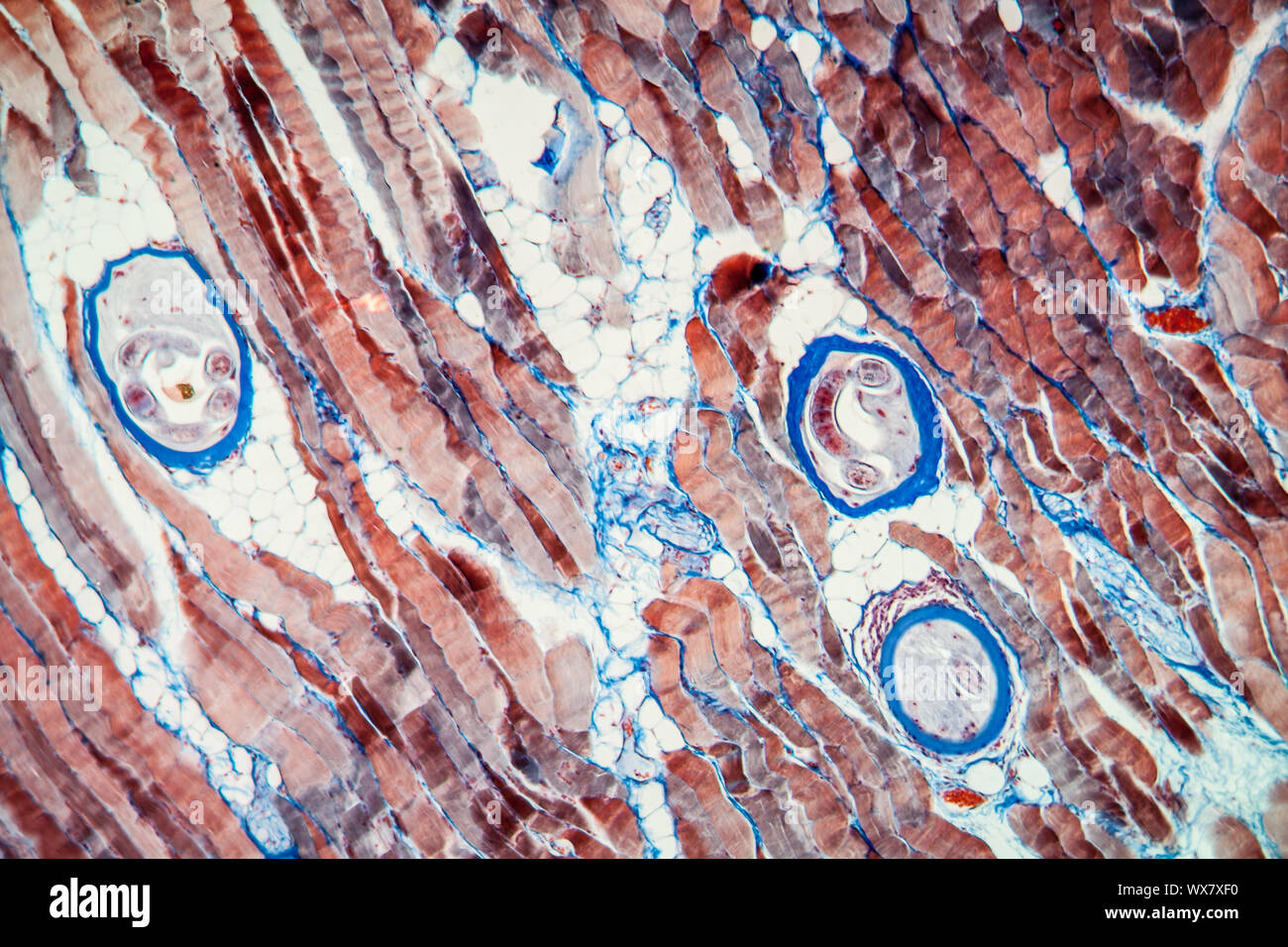 Trichinae parasites in muscle tissue 100x Stock Photo - Alamy