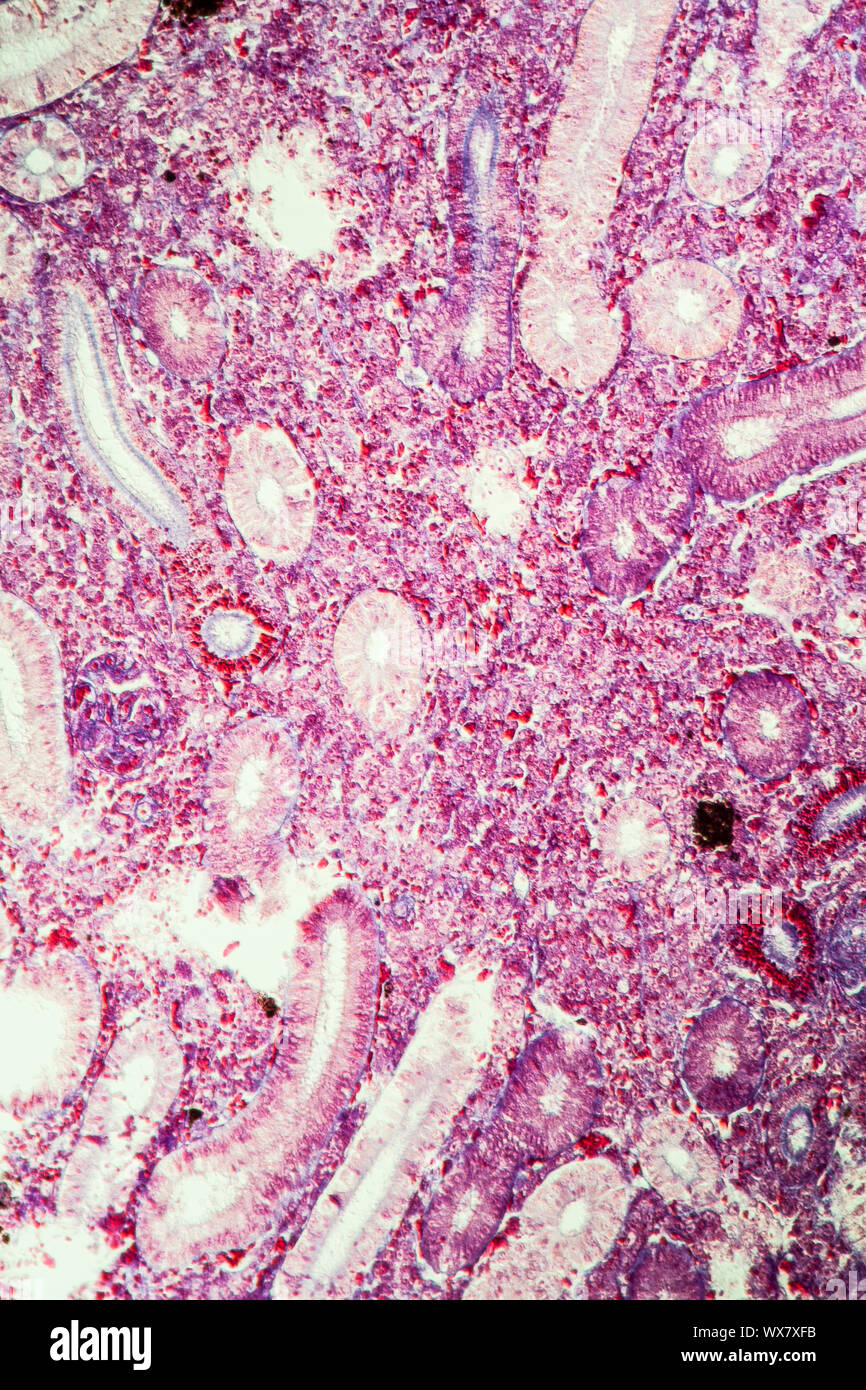 Pike kidney cross section 100x Stock Photo - Alamy