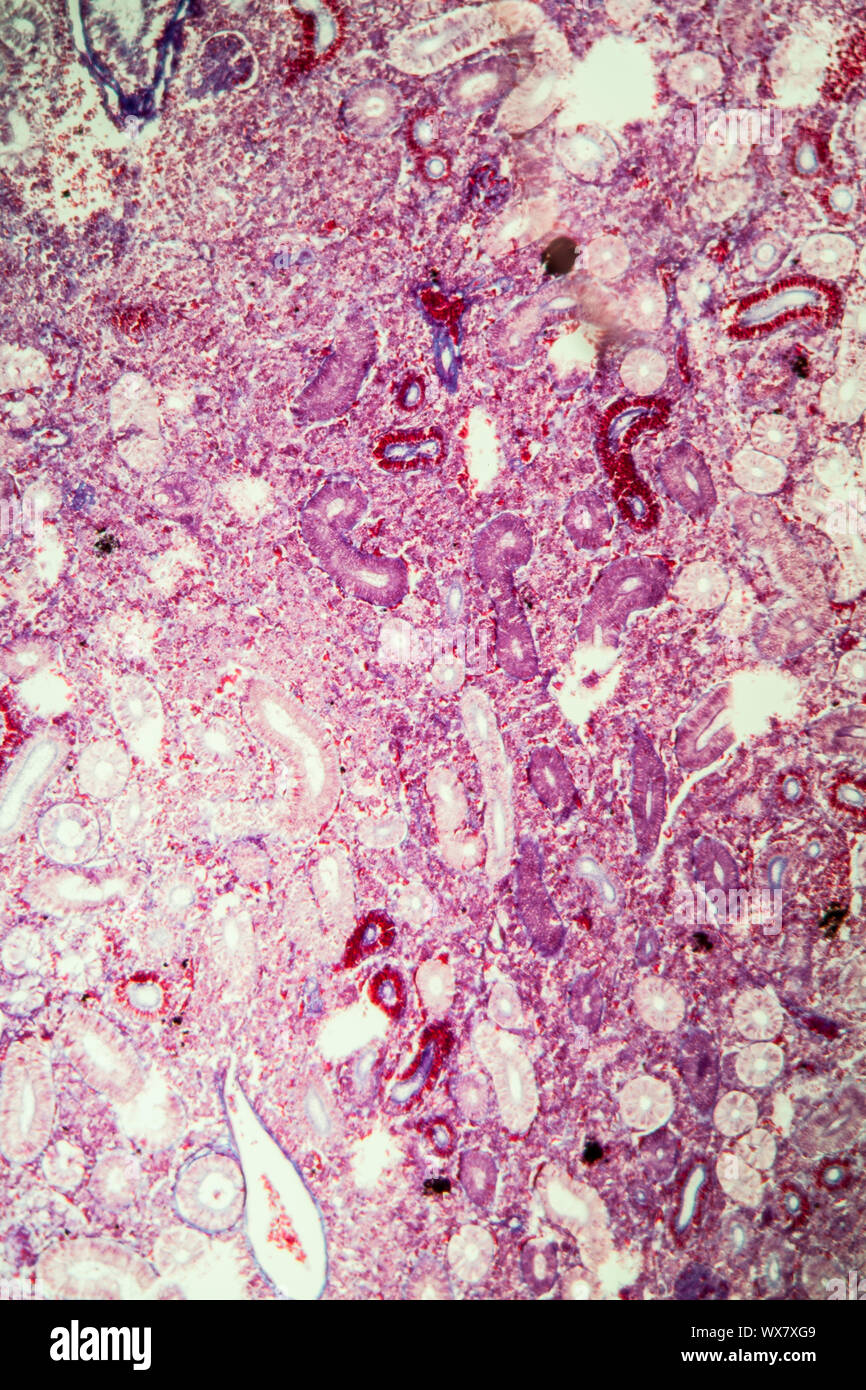 Pike kidney cross section 100x Stock Photo - Alamy