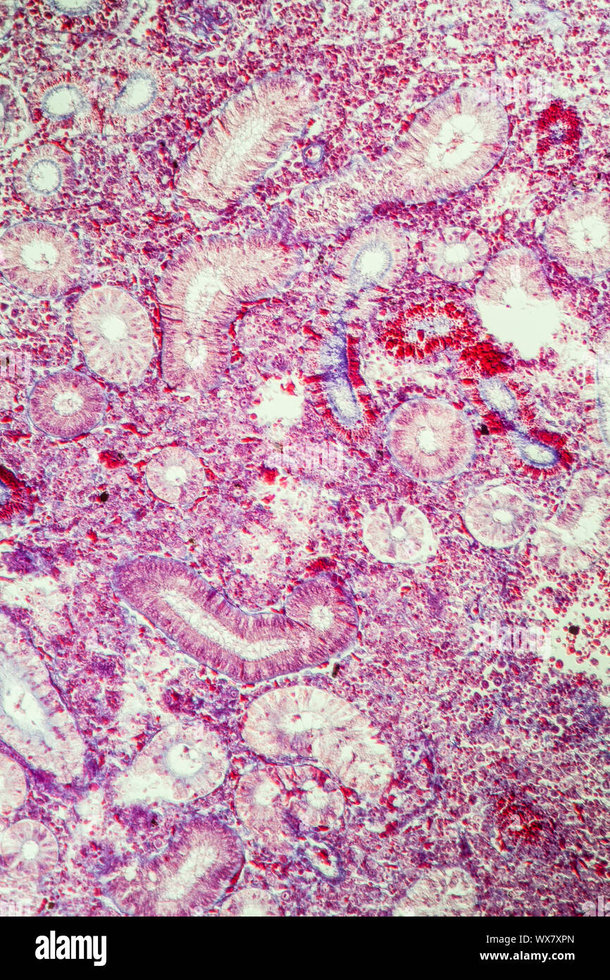 Pike kidney cross section 100x Stock Photo - Alamy