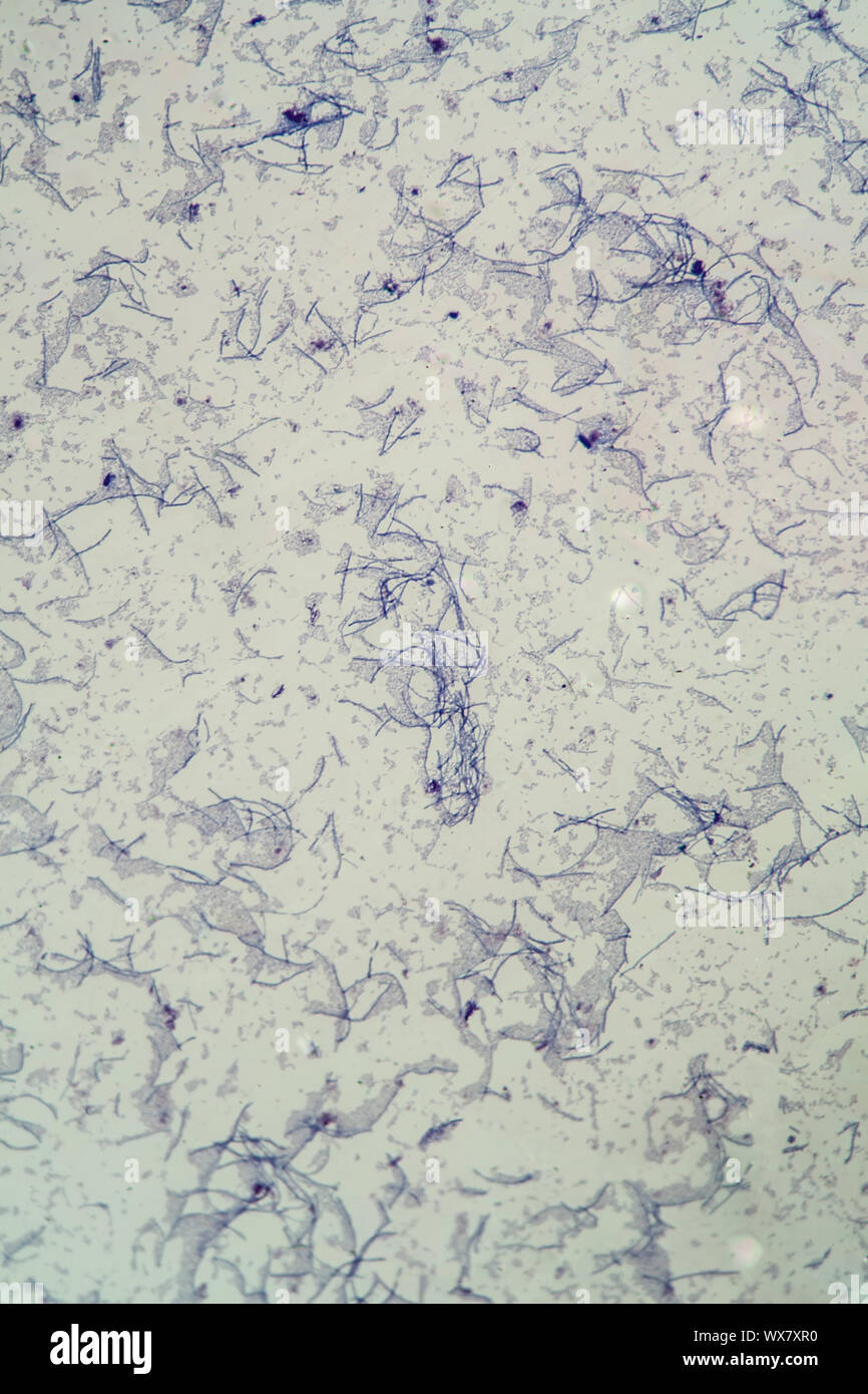 Bacteria from the dental plaque 200x Stock Photo - Alamy