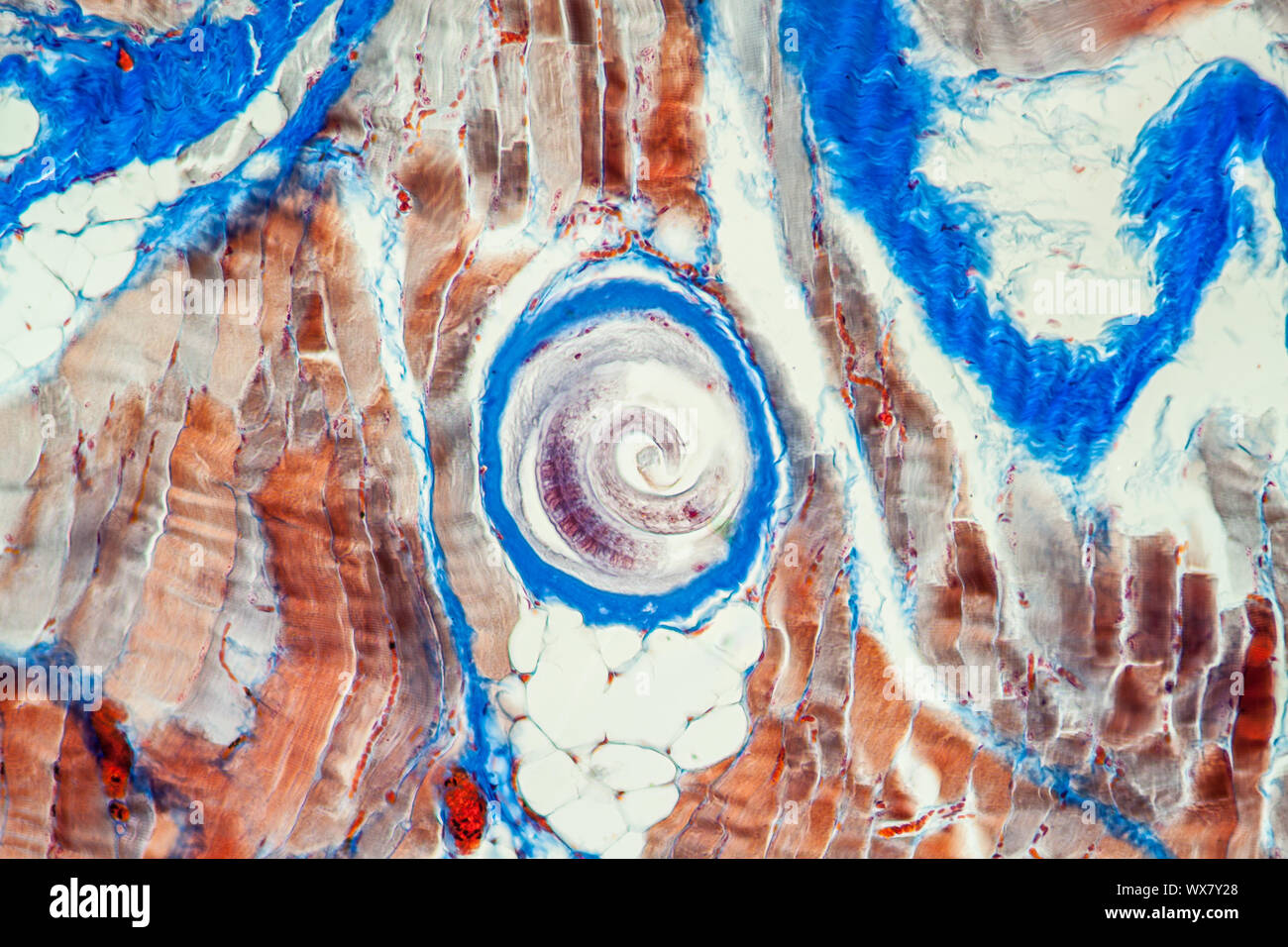 Trichinae parasites in muscle tissue 200x Stock Photo - Alamy