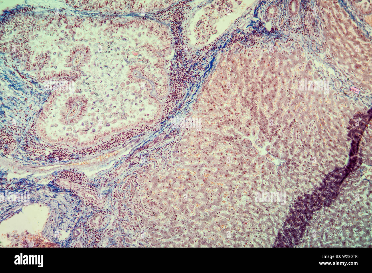 Coccidiosis in rabbit liver tissue under the microscope 100x Stock ...