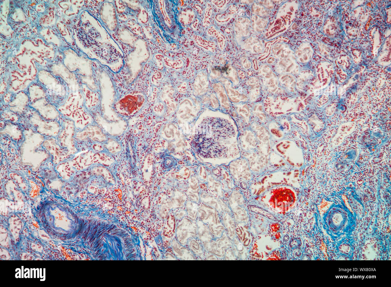 Atrophy hi-res stock photography and images - Alamy