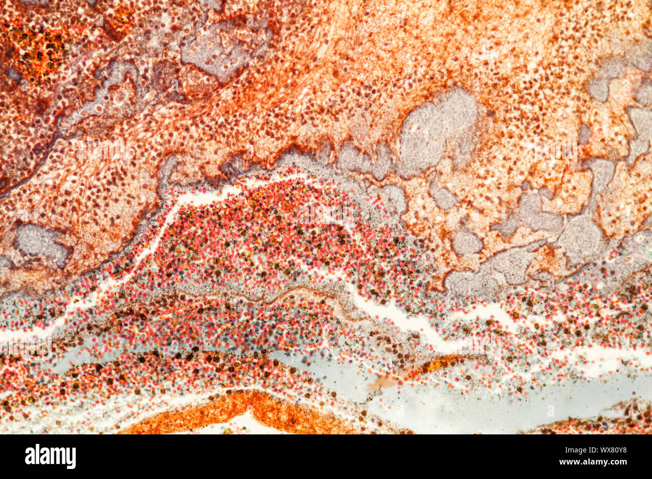 Heart fatty tissue under the microscope 200x Stock Photo - Alamy