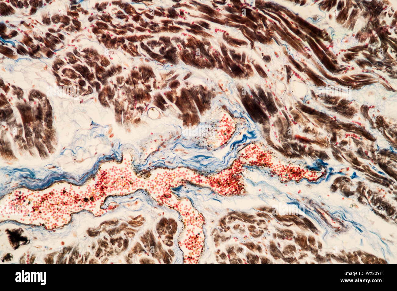 Heart fatty tissue under the microscope 200x Stock Photo - Alamy