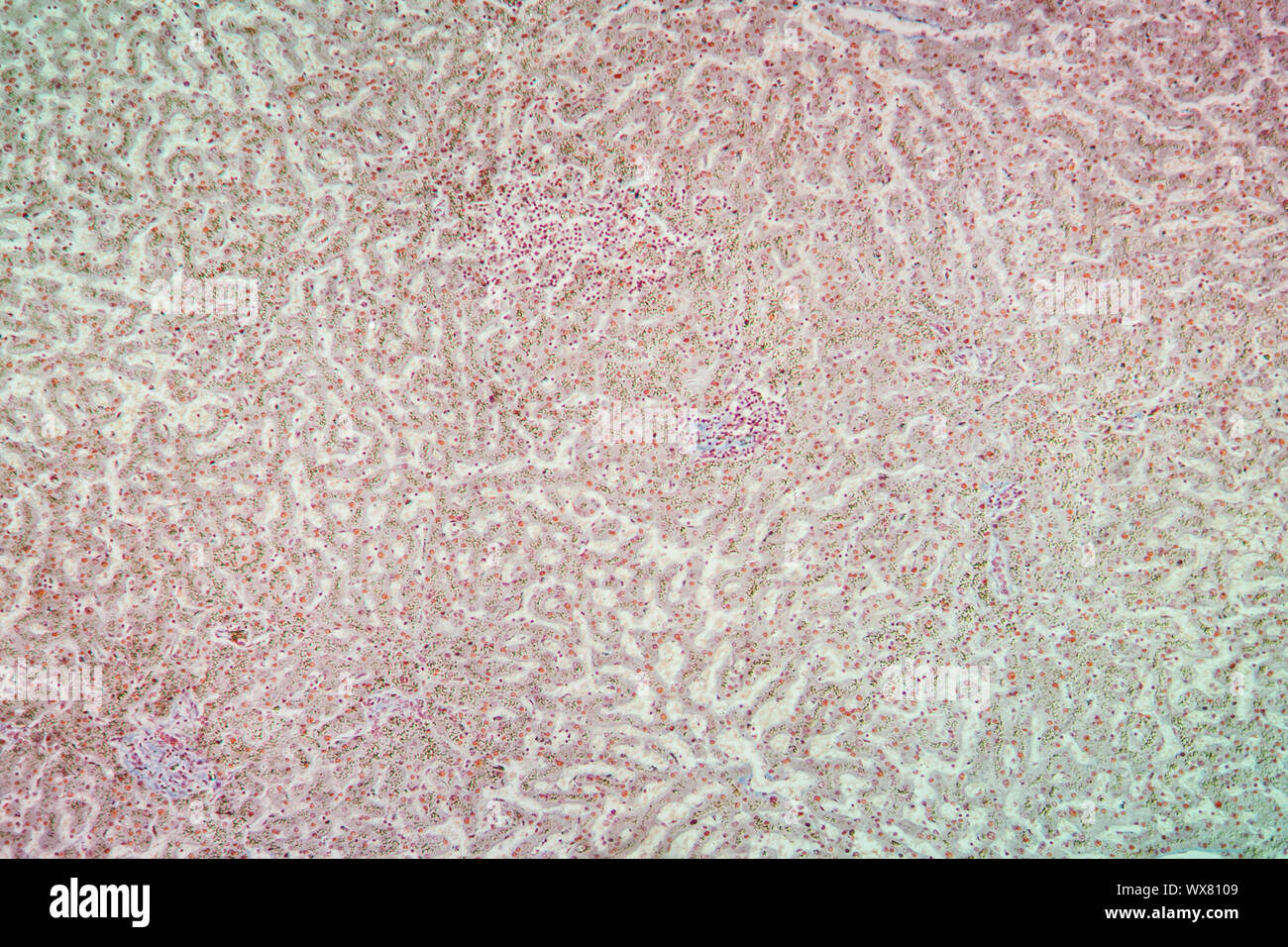 Hemosiderosis of the liver tissue under the microscope 100x Stock Photo ...