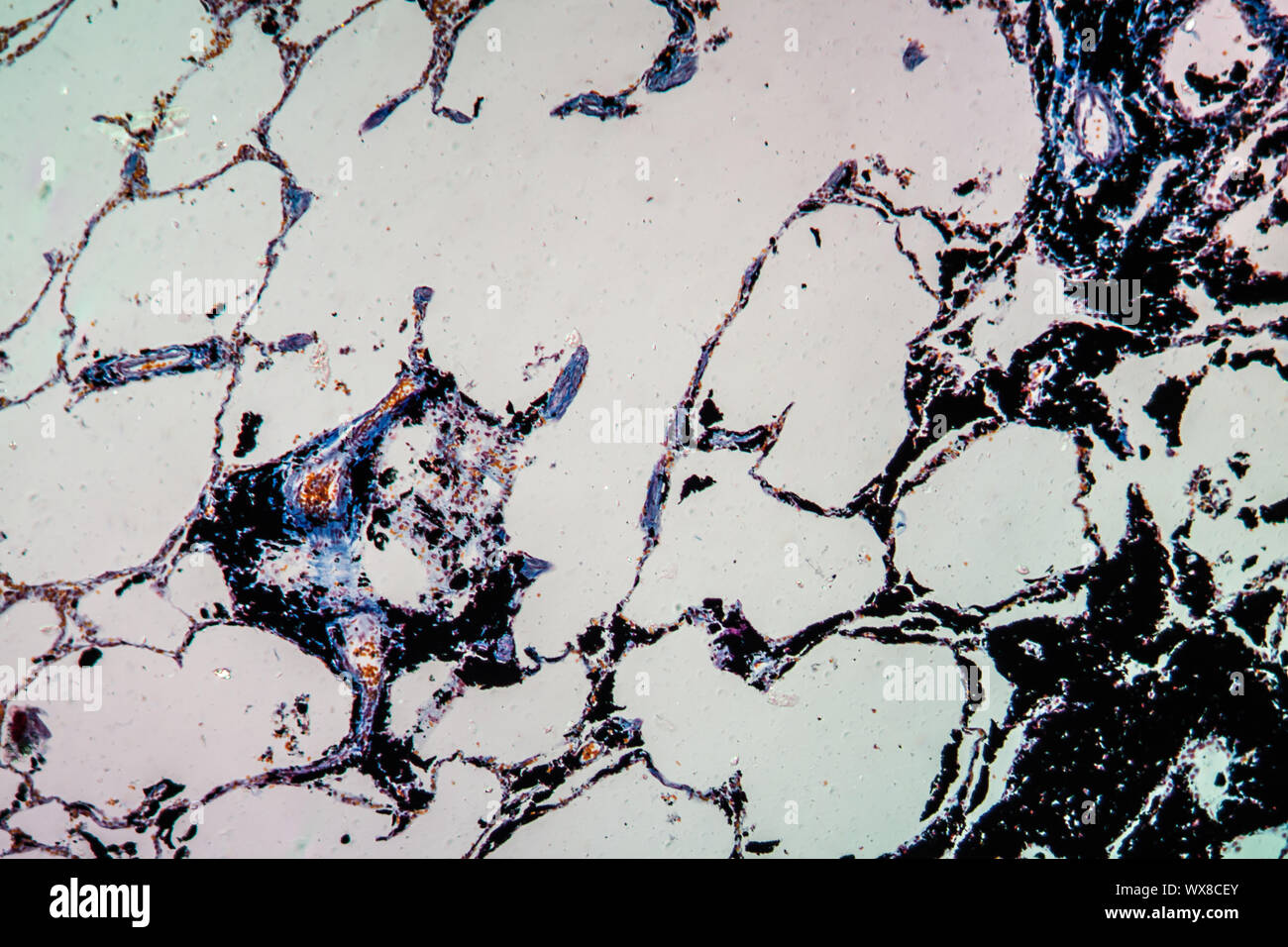 Coal-dust tissue under the microscope 100x Stock Photo - Alamy