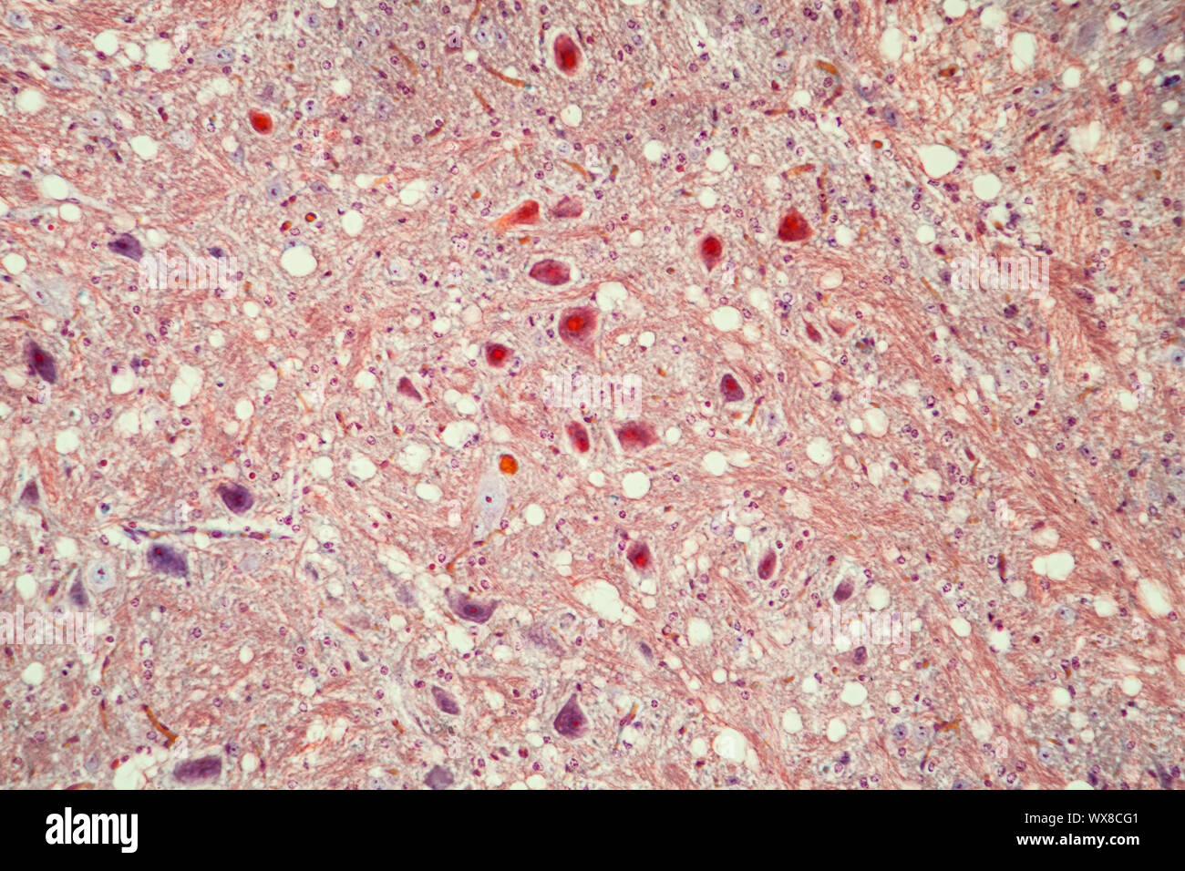 Brain Cells High Resolution Stock Photography and Images - Alamy